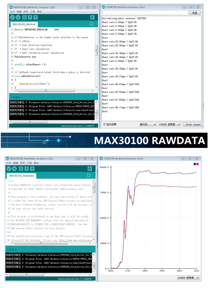 Open media 10 in modal
