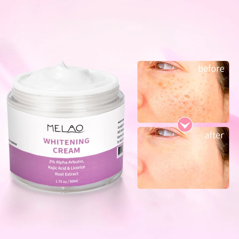 MELAO Whitening Cream Dark Skin Cream Moisturizing Brighten Face Under ...