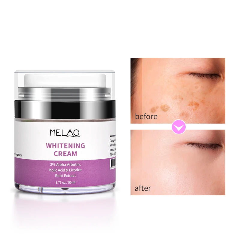 MELAO Whitening Cream Dark Skin Cream Moisturizing Brighten Face Under ...