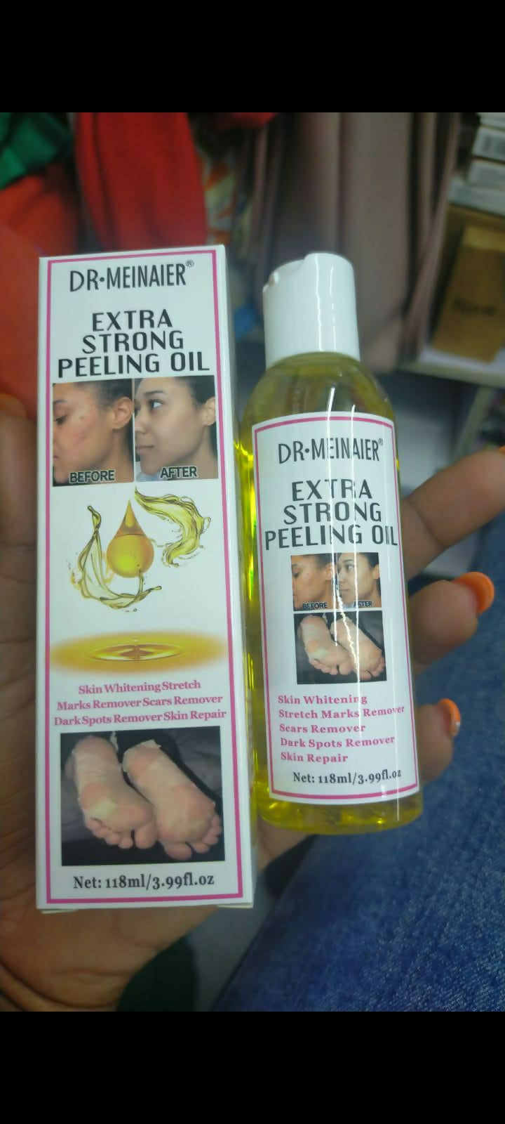 Extra Strong Peeling Oil Elbows Knees Hands Even Complexion – NairoMarket