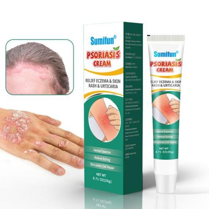 Psoriasis Cream, For Dermatitis, Psoriasis, Shingles, Rash, Eczema ...